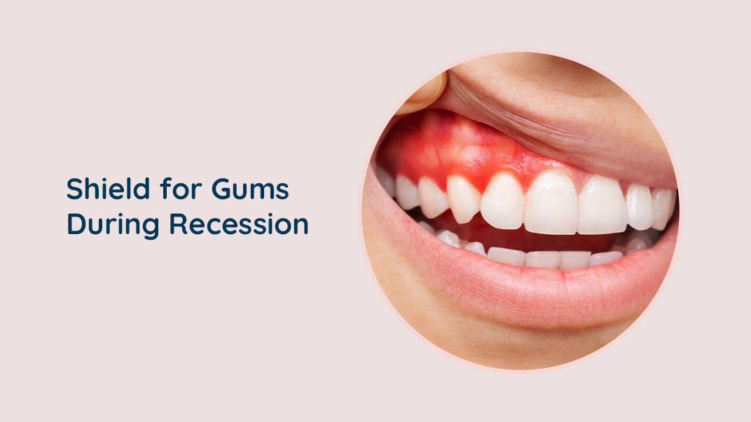 Tips for Preventing Recession During Dental Procedures