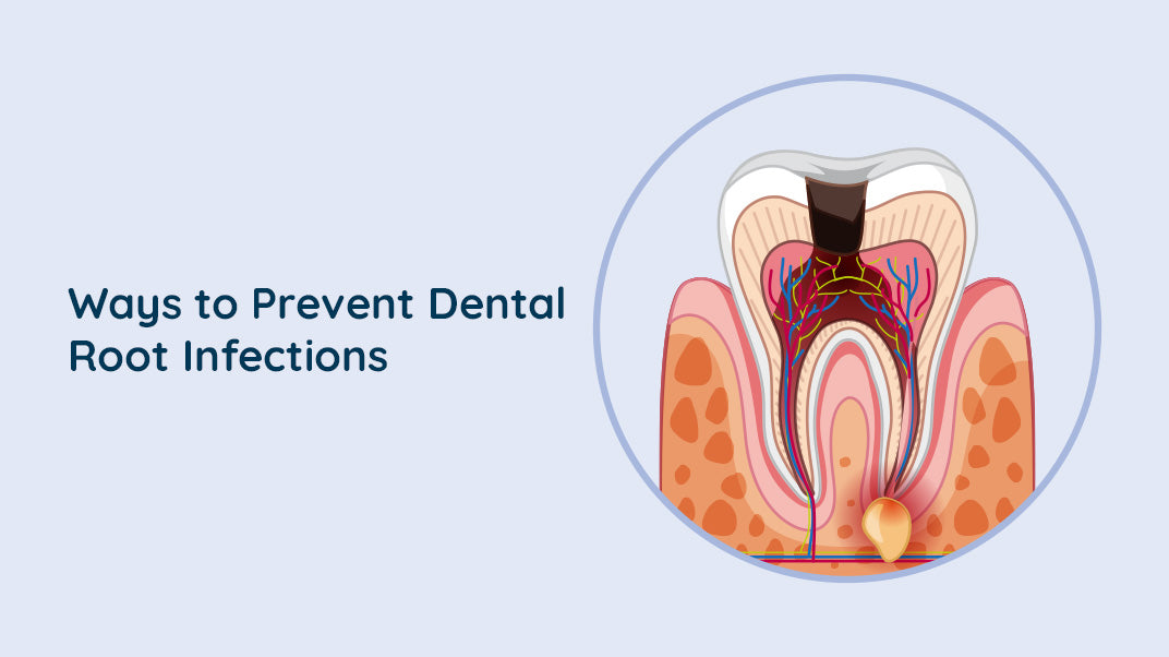 Preventing Dental Root Infections: Tips for Maintaining Oral Health ...