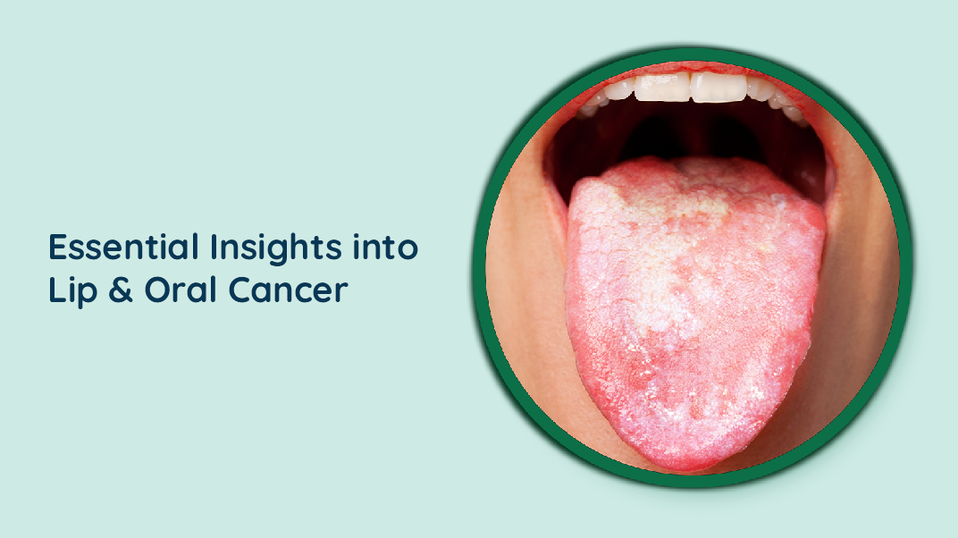 Unmasking the Truth: Things you should know about Lip & Oral Cancer