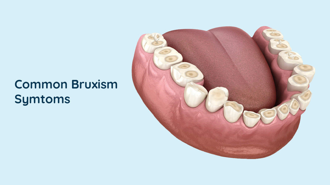 Unveiling the Clues - Identifying the Symptoms of Bruxism | ORACURA
