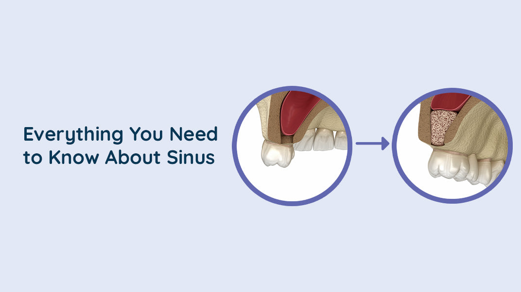 Everything You Need to Know About Sinus Lift | ORACURA